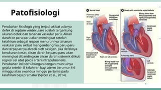 Ventricular septal defect (VSD) adalah kelainan jantung | PPTX