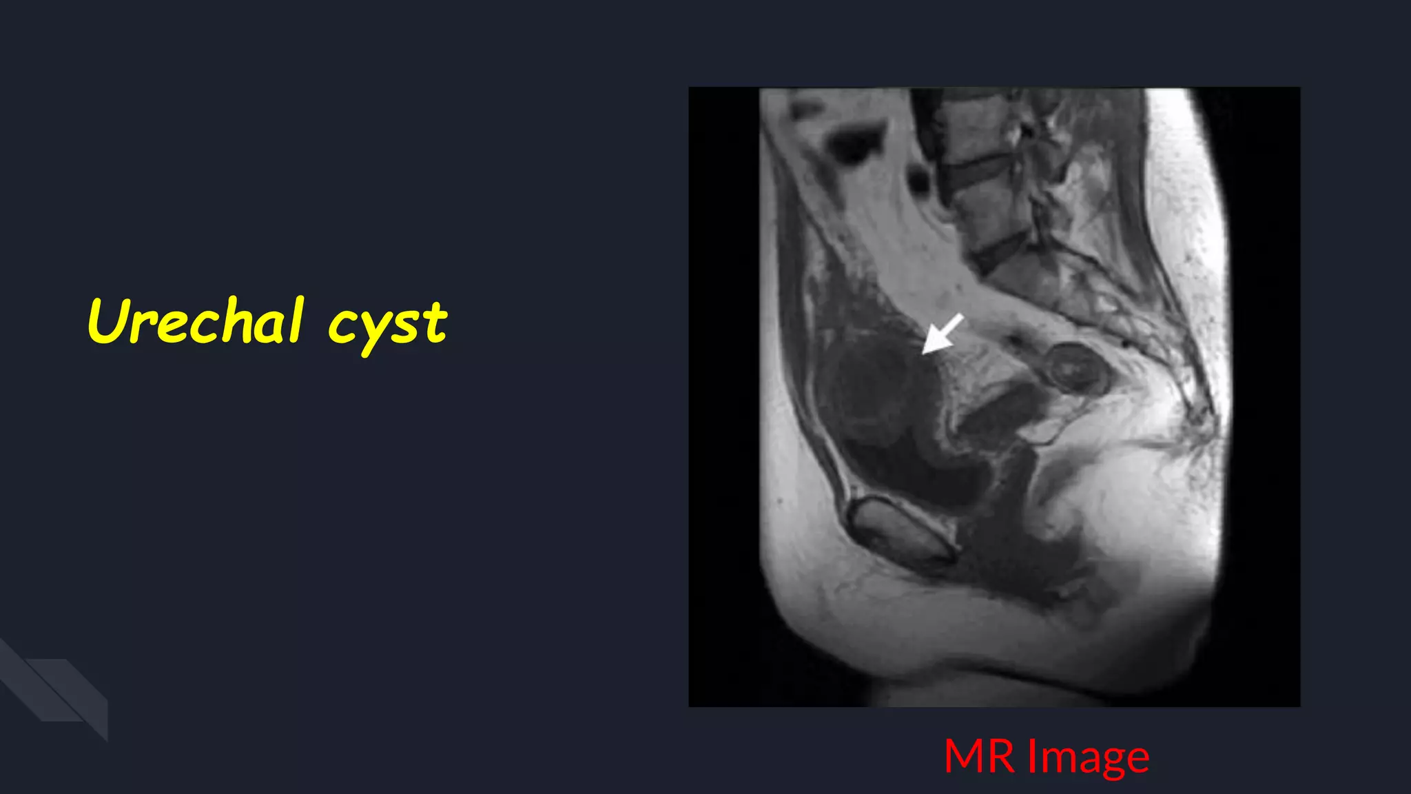 ASU & MCU --- RADIOLOGY IMAGING PROCEDURE | PPTX