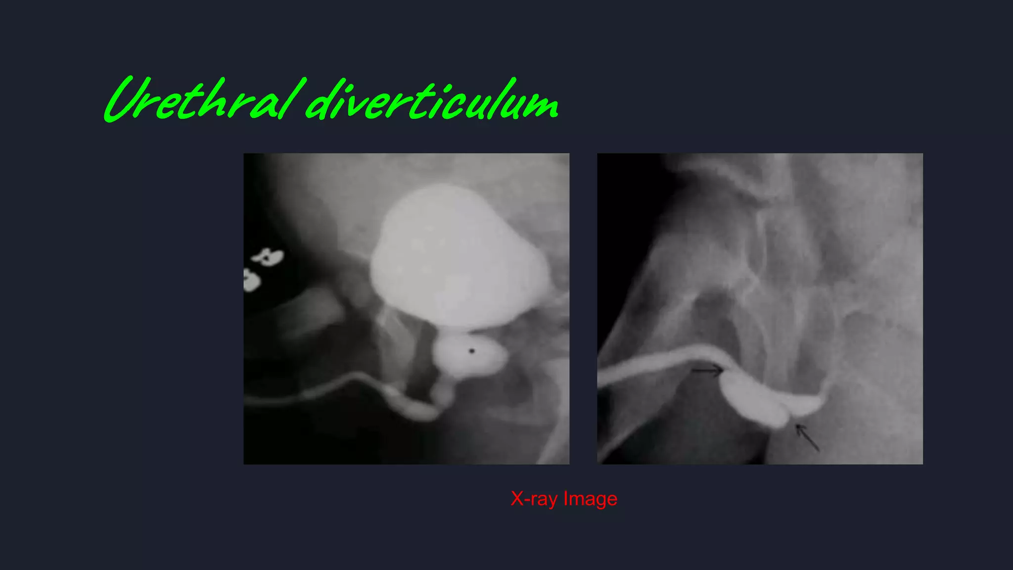 ASU & MCU --- RADIOLOGY IMAGING PROCEDURE | PPTX