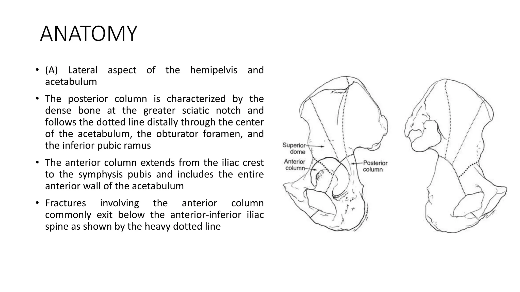 A summary of fractures of acetabulum | PPT