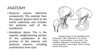 A summary of fractures of acetabulum | PPT
