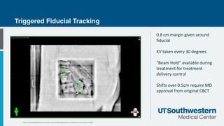 A Surface Guided Method to Improved Pancreatic SBRT Patient Experience ...