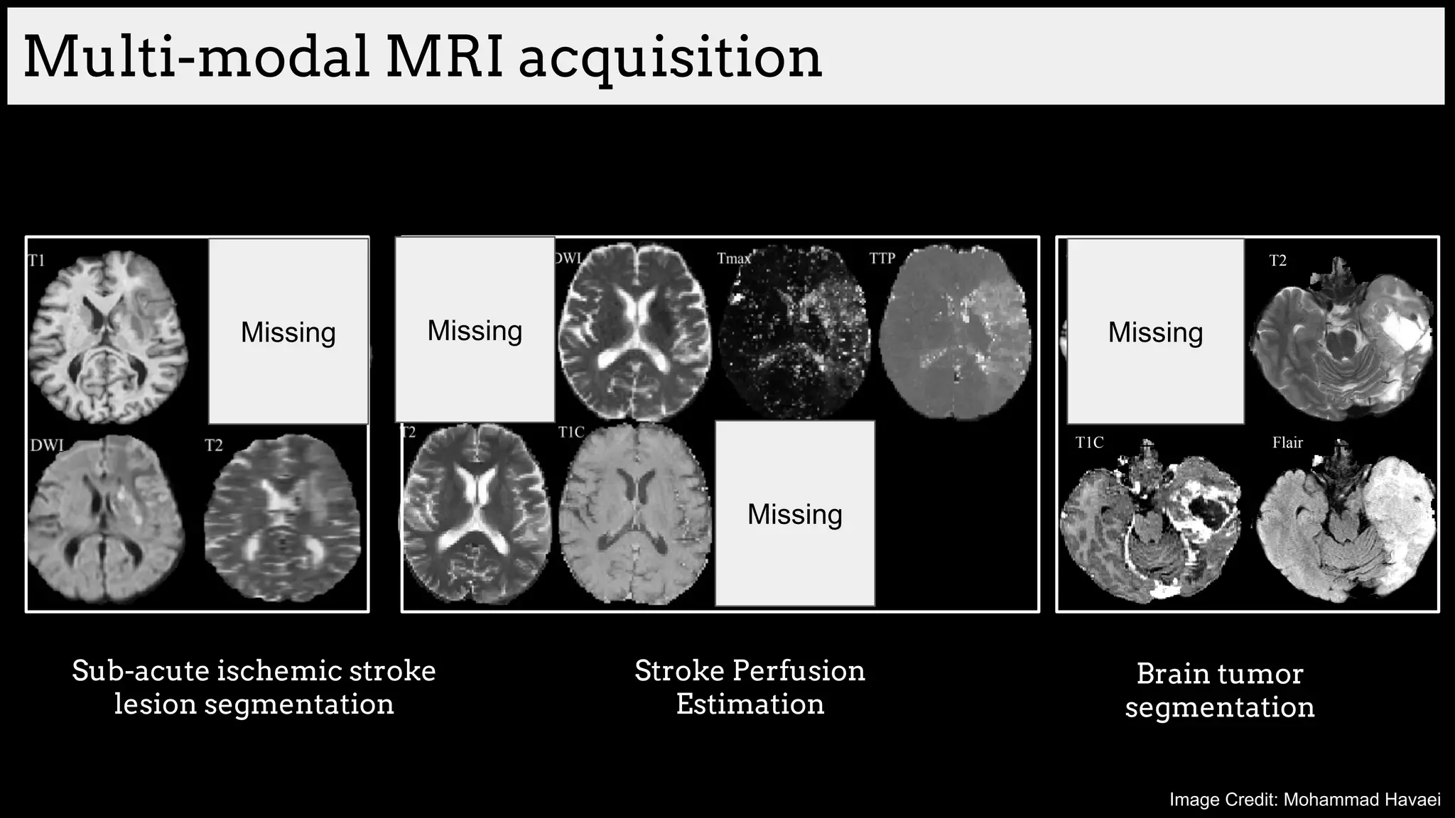 A survey of deep learning approaches to medical applications | PDF