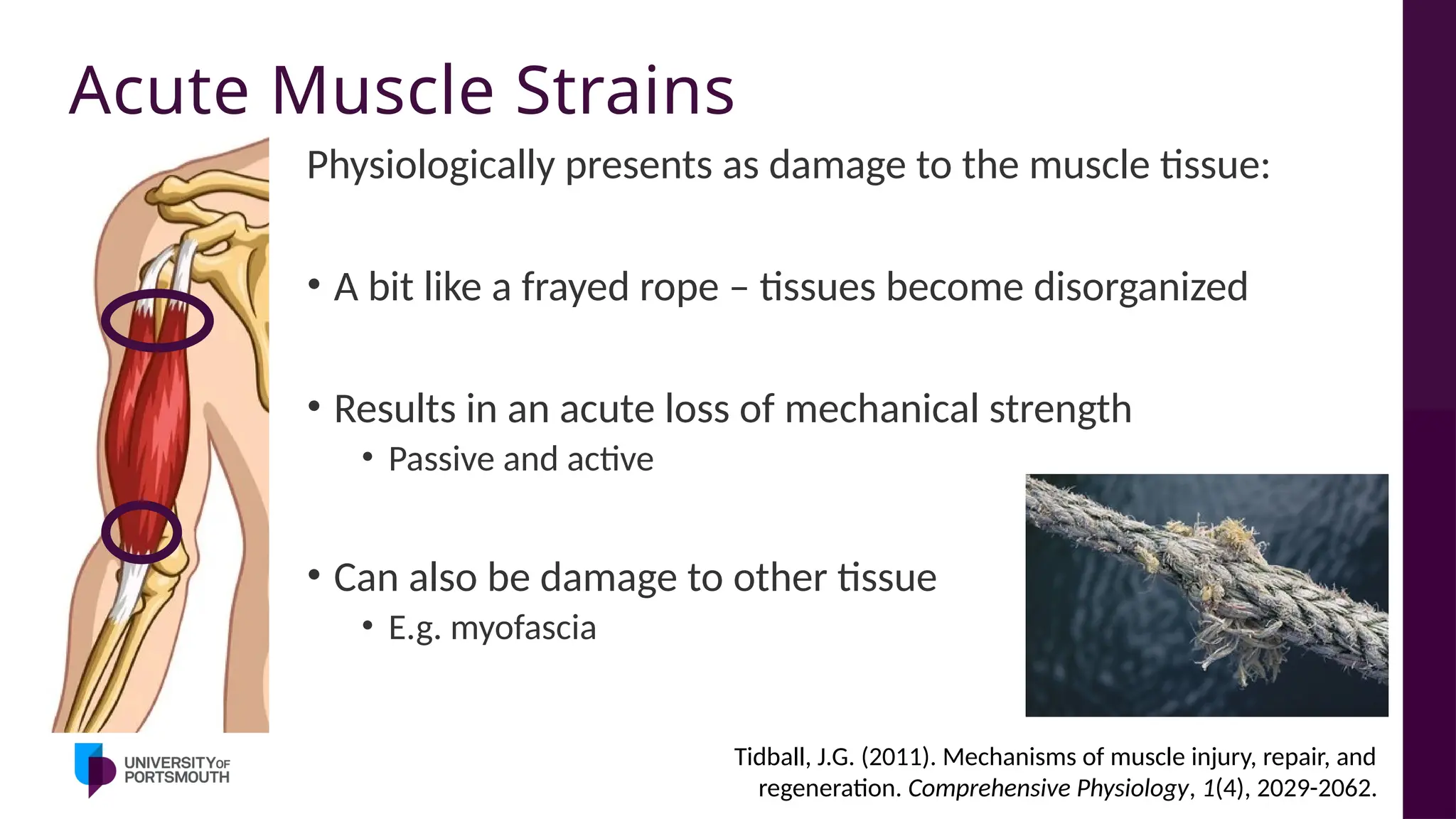 Asynch - Types of MTU injuries part 1.pptx
