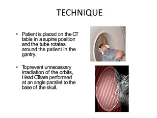A systematic approach to ct brain | PPT