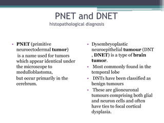 A systematic approach to possible case of brain | PPT