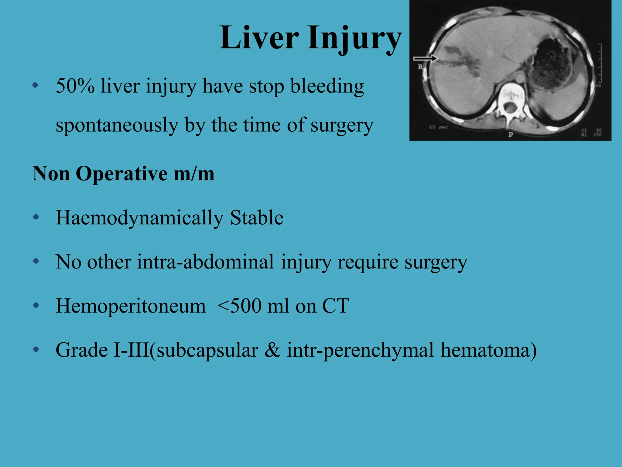 Abdominal trauma and assessment with primary and secondary survey. pptx ...