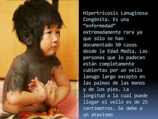 Atavismo presentacion | PPTX