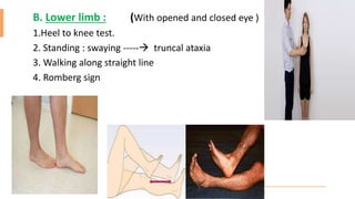 ataxia | PPTX