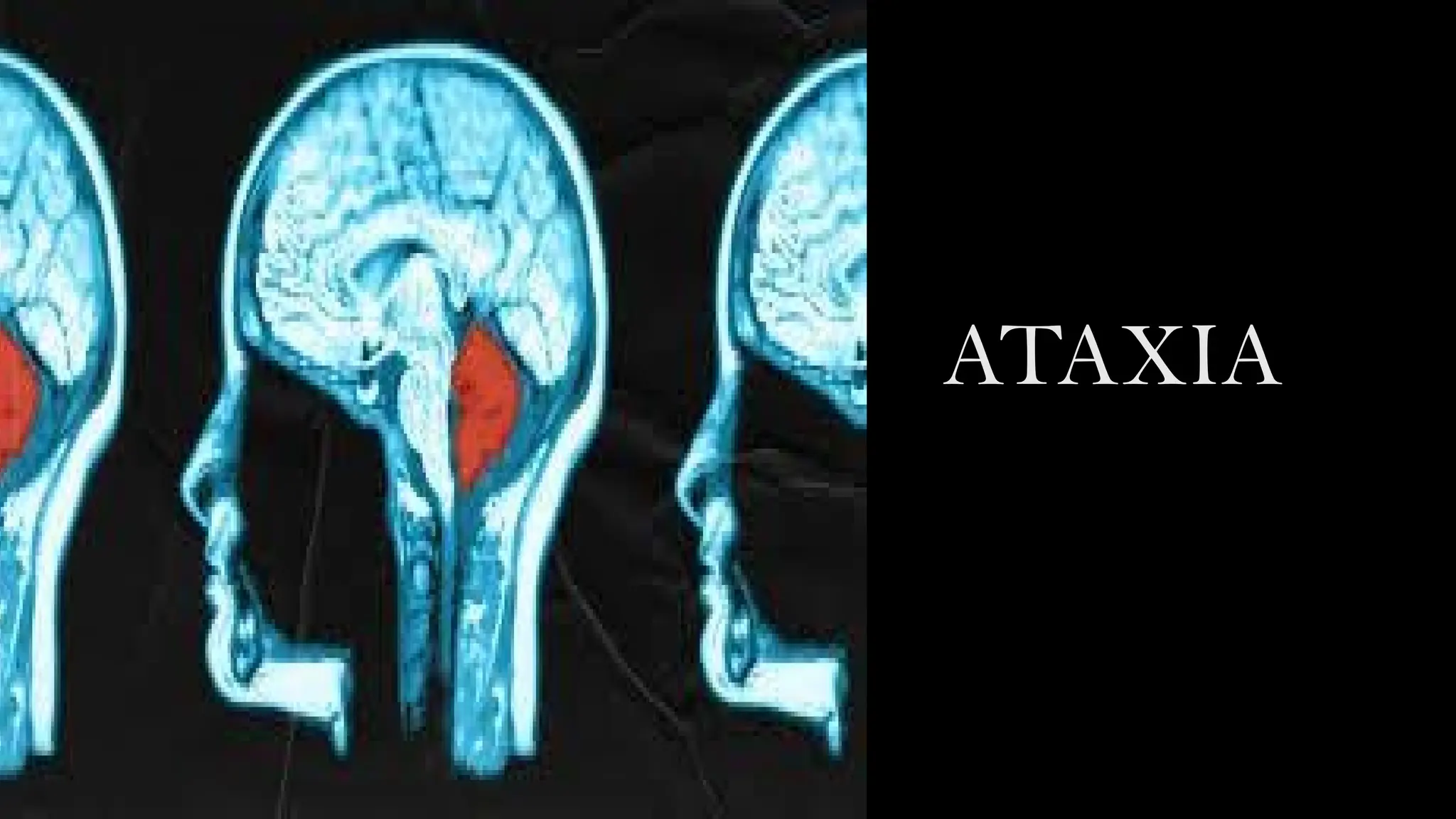 the neurobiology of ataxia, its symptoms, and how it affects the body | PPTX
