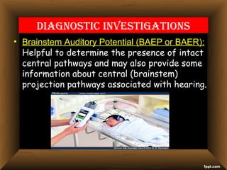 Ataxia diagnosis and assessment | PPT