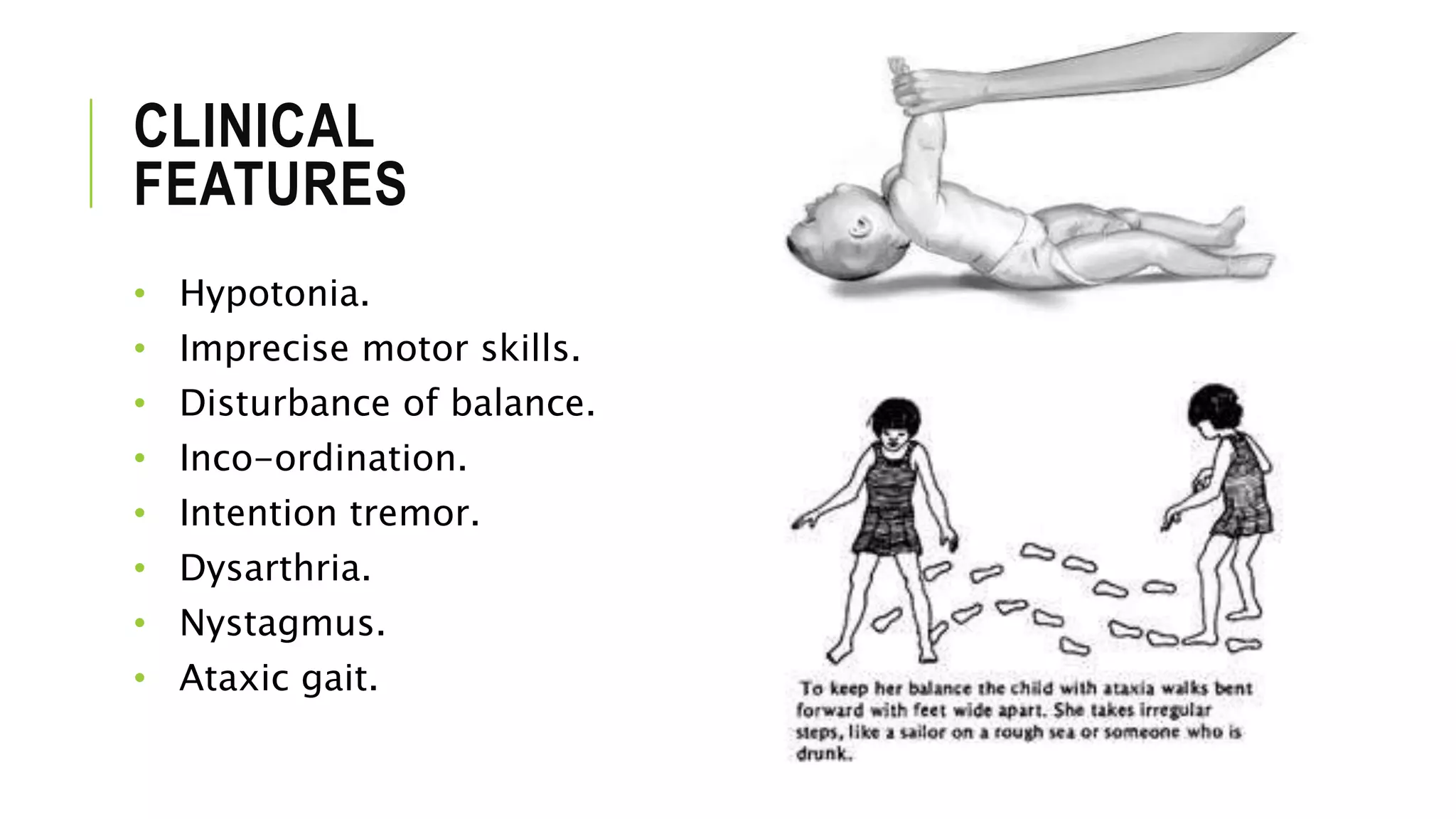 Ataxic Cerebral Palsy.pptx