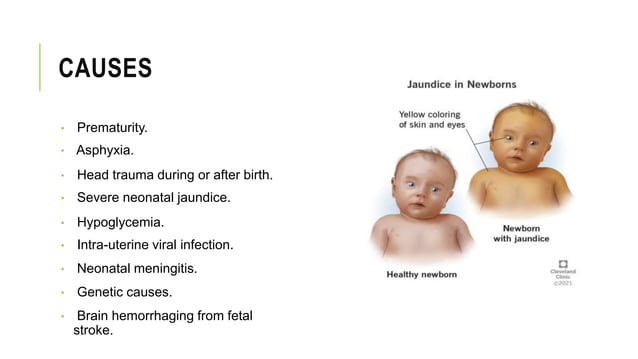 Ataxic Cerebral Palsy.pptx | Brain and Nervous System Disorders ...