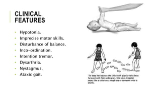 Ataxic Cerebral Palsy.pptx | Brain and Nervous System Disorders ...