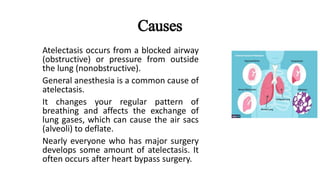 ATELACTASIS.pptx | Lung and Respiratory Health | Diseases and Conditions