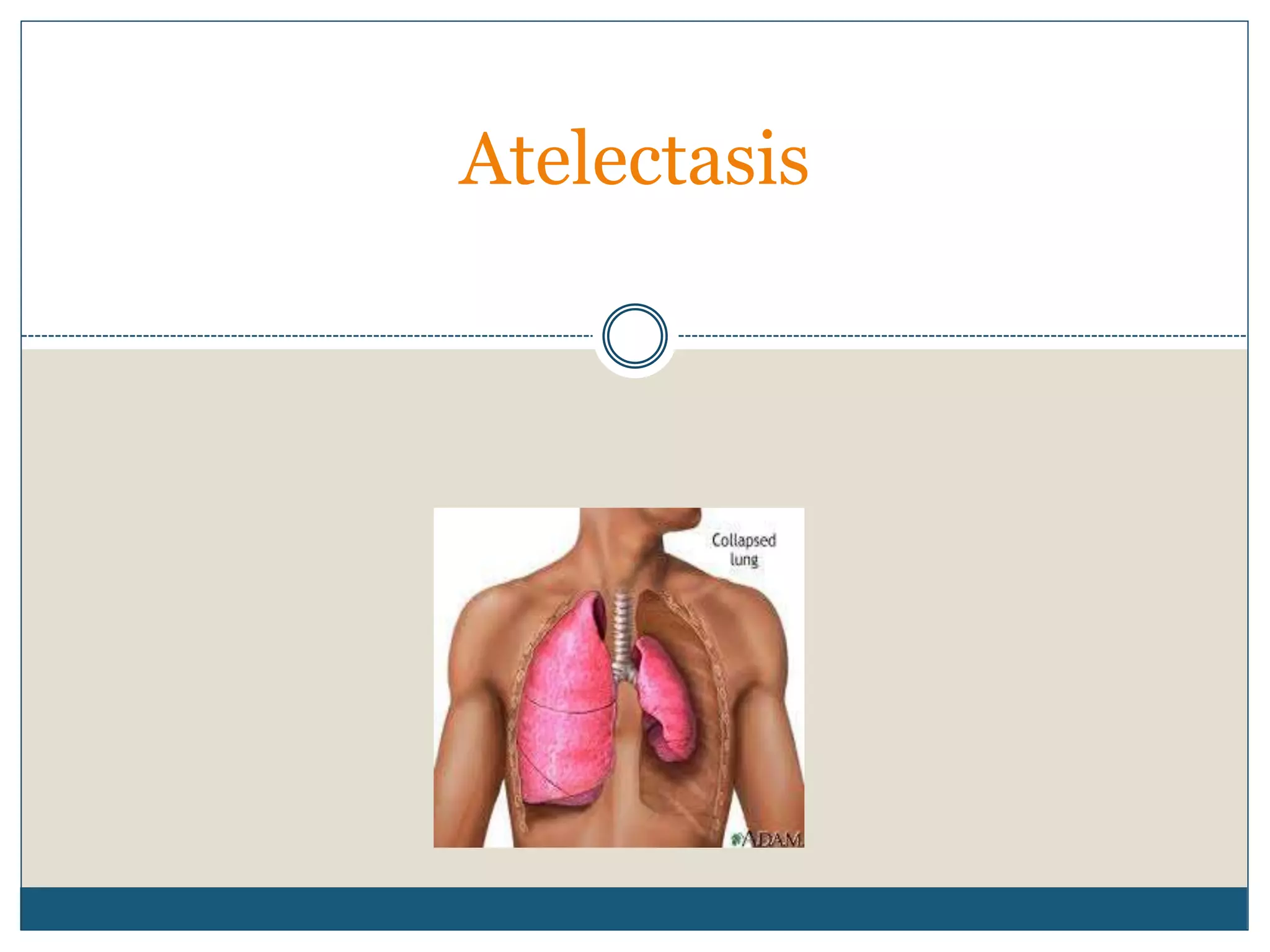 Atelectasis | PPTX