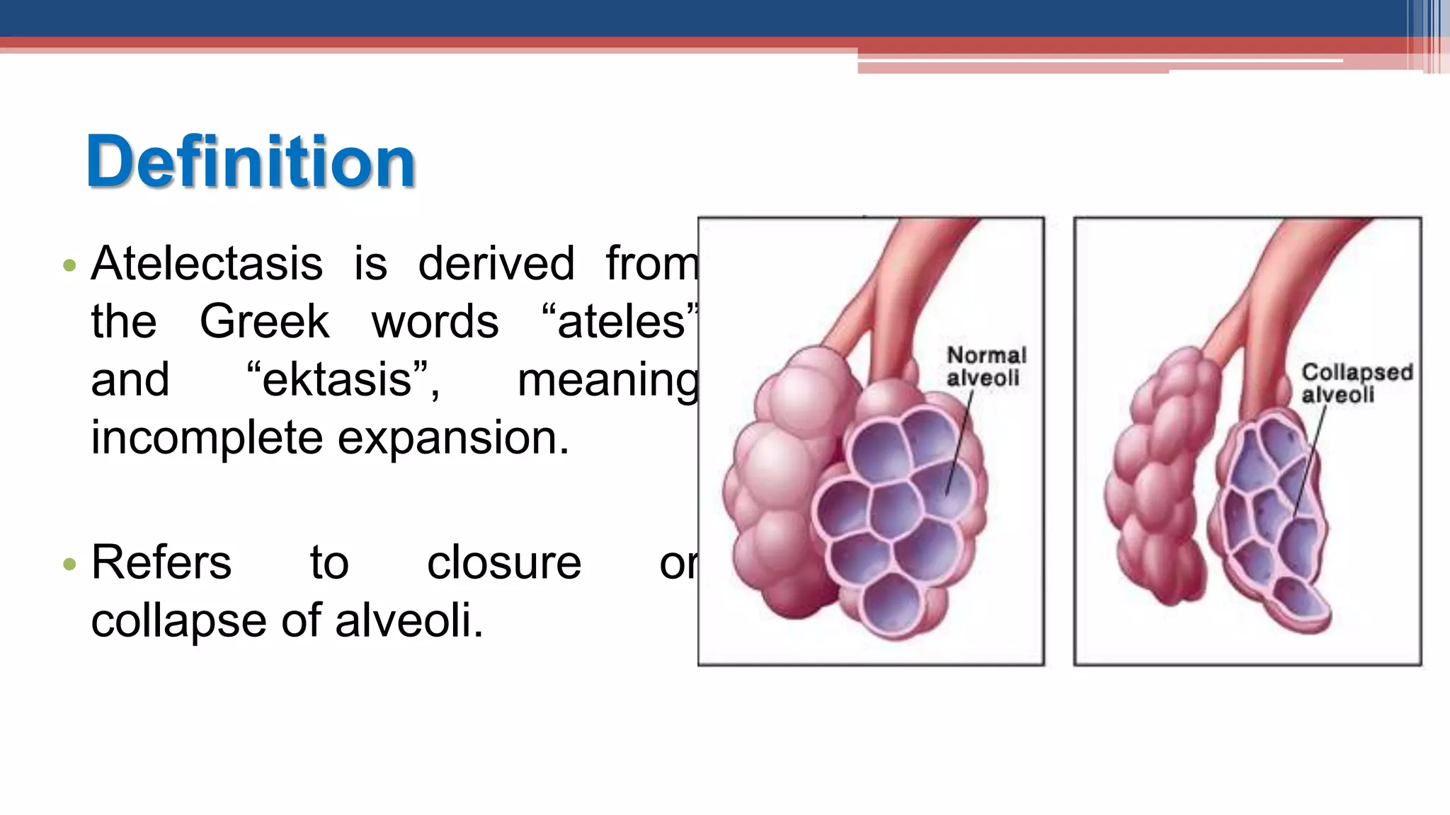 Atelectasis | PPTX