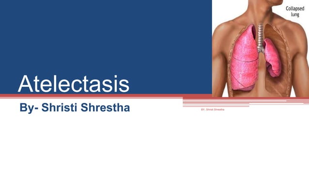 Atelectasis | PPTX | Lung and Respiratory Health | Diseases and Conditions