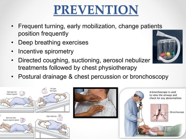 Atelectasis- Easy explanation | PPT