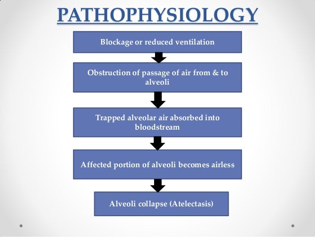 Atelectasis- Easy explanation