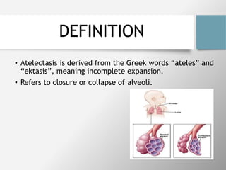 Atelectasis Alveoli
