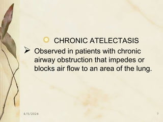 Atelectasis-Edited.ppt for medical surgical nursing 1 | PPT