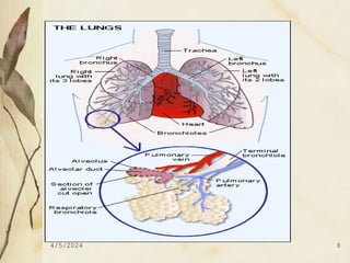 Atelectasis-Edited.ppt for medical surgical nursing 1 | PPT