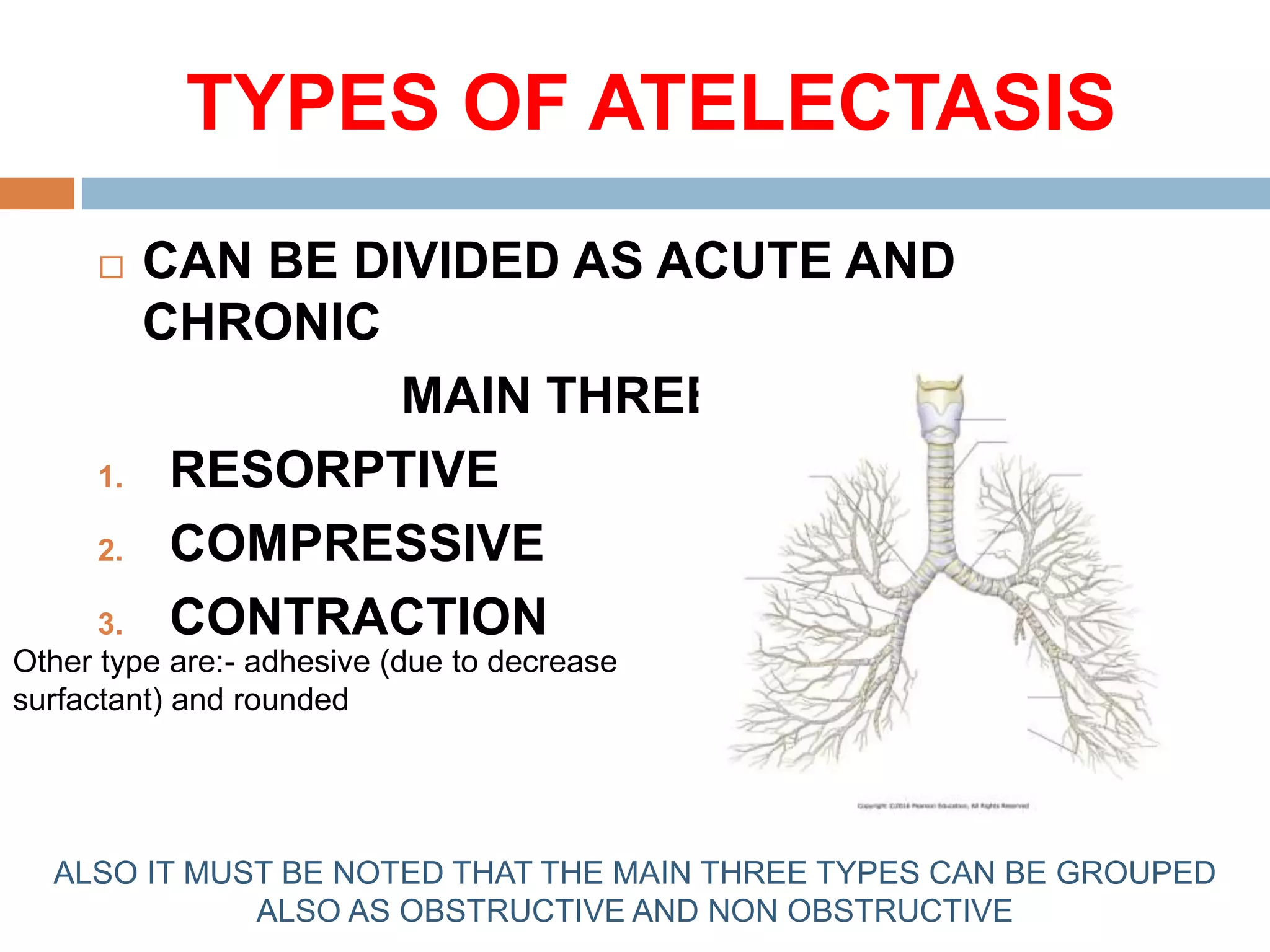 Atelectasis | PPTX