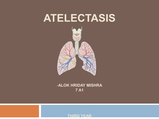 Atelectasis | PPTX