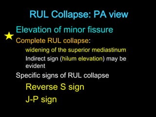 Atelectasis and collapse in CXR | PPTX