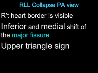 Atelectasis and collapse in CXR | PPTX