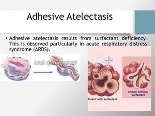 Atelectasis - a respiratory disorder | PPTX