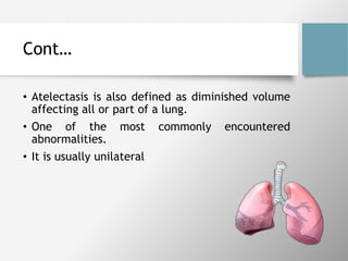 Atelectasis - a respiratory disorder | PPTX