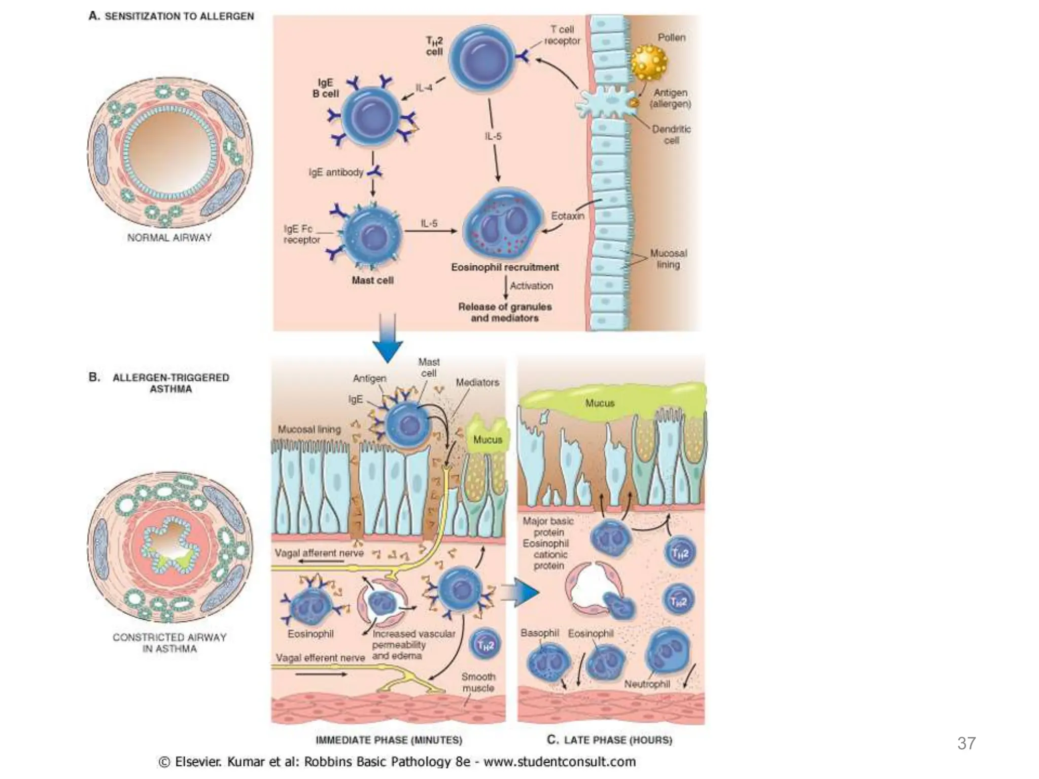 Atelectasis, restrictive and obstructive pulmonary disease.pptx