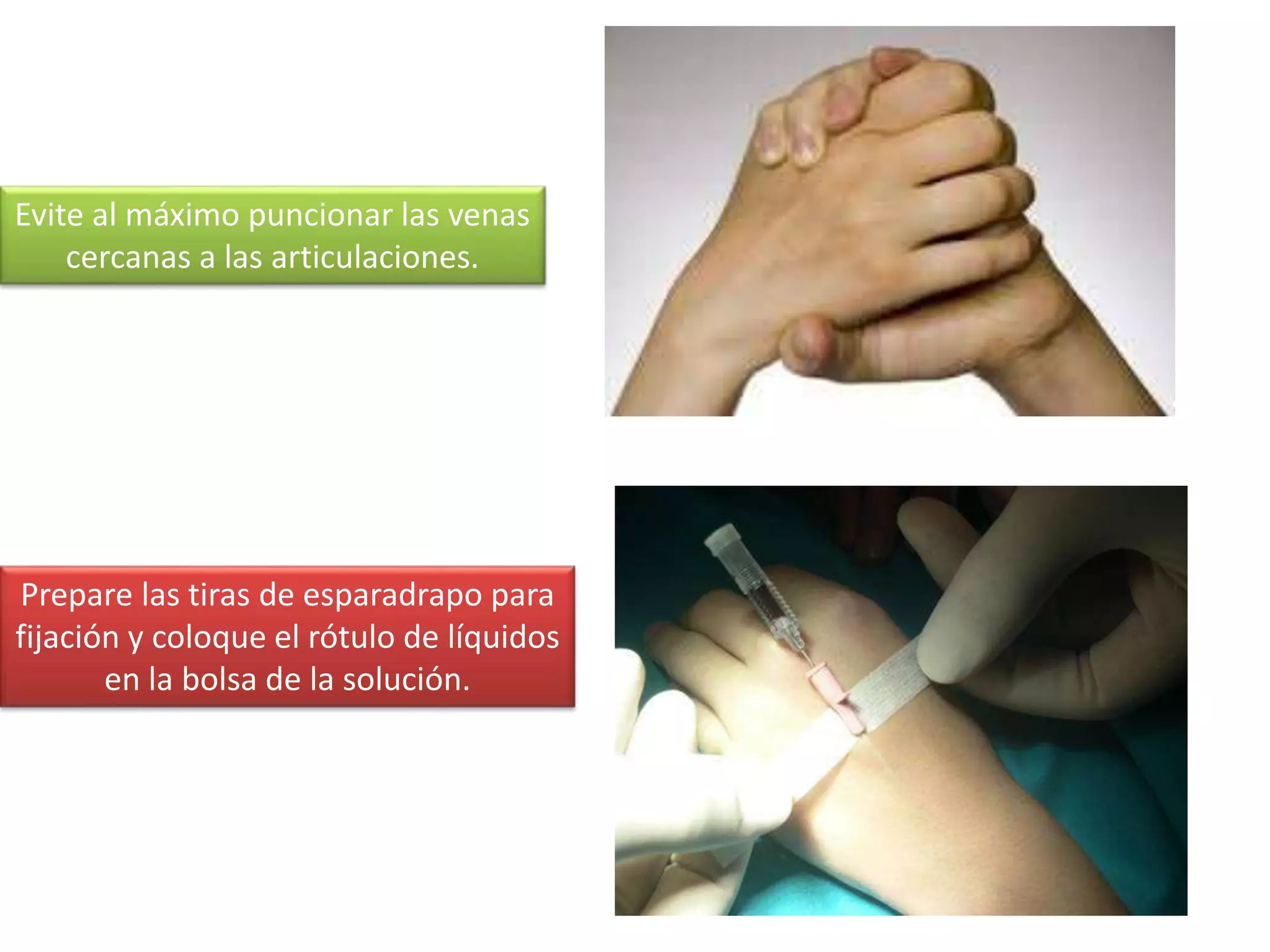 CanalizaciÓn De Vena Ppt