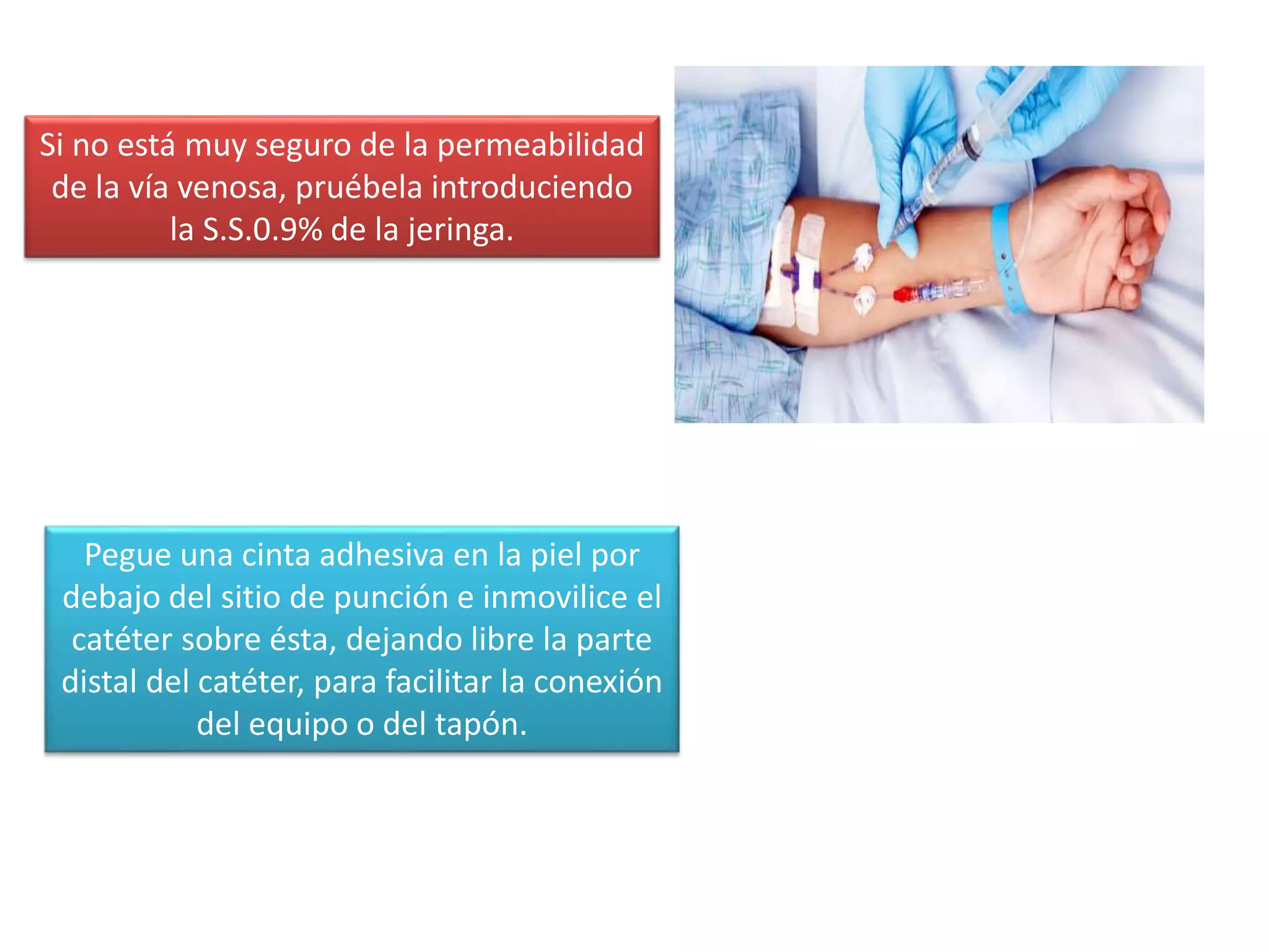 CANALIZACIÓN DE VENA | PPTX