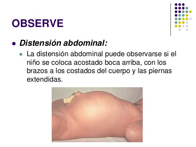 Atención al niño (a) de 0 a 2 meses