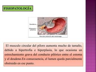 Atención de enfermería con trastornos obstructivos y hepatopatiias | PPTX