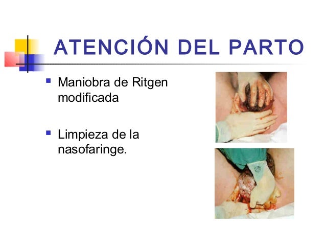 Atención Y Mecanismo De Parto