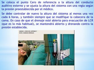 Atencion de enfermeria a pacientes con drenaje ventricular externo | PPTX