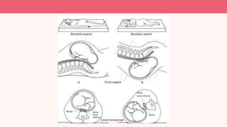 Atencion del parto normal y pelvico (maniobras especiales)1[1].potx