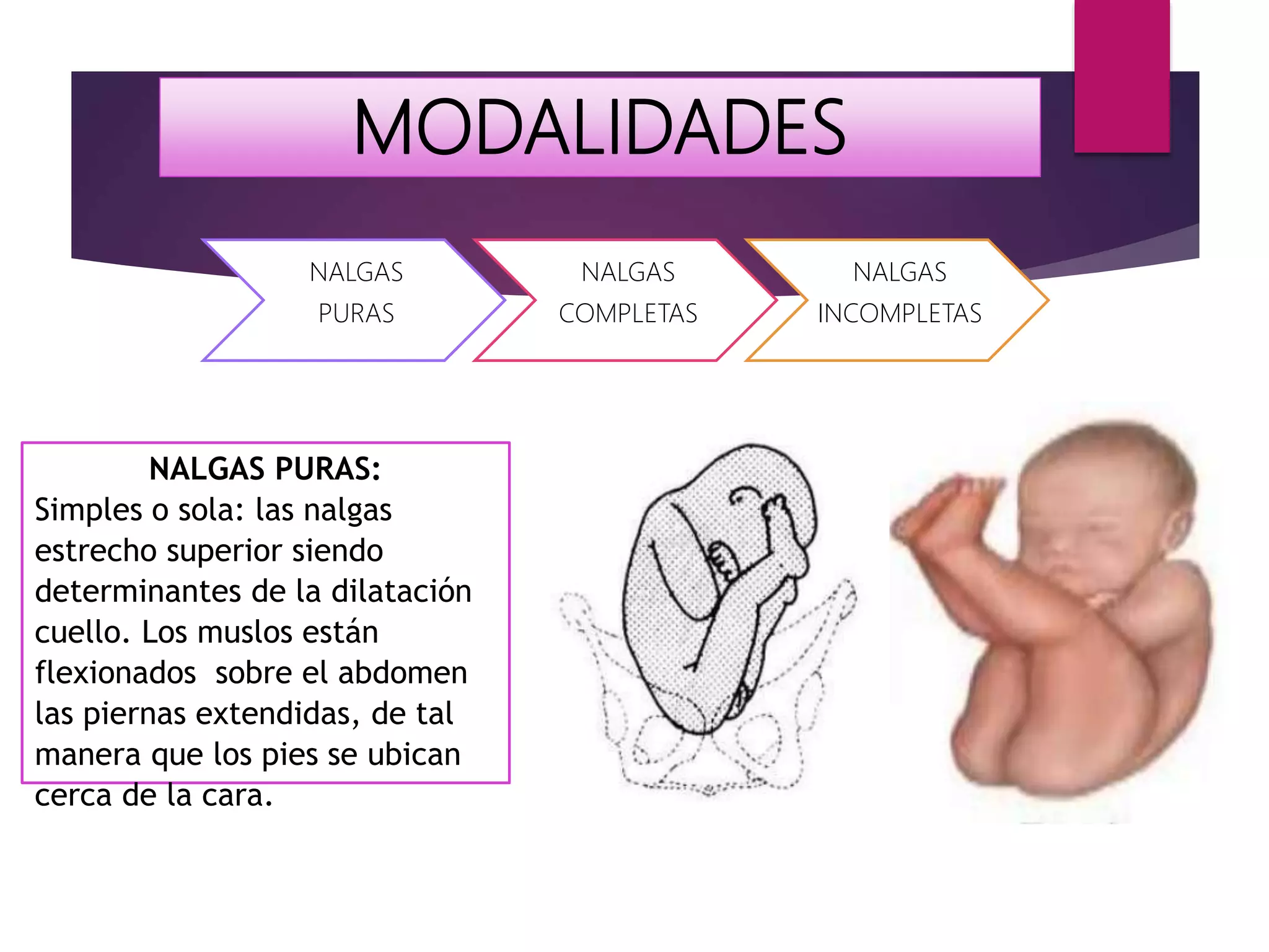 Atencion del parto podalico | PPTX