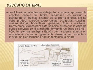 Atención Enfermeria en Úlceras por Decubito | PPT