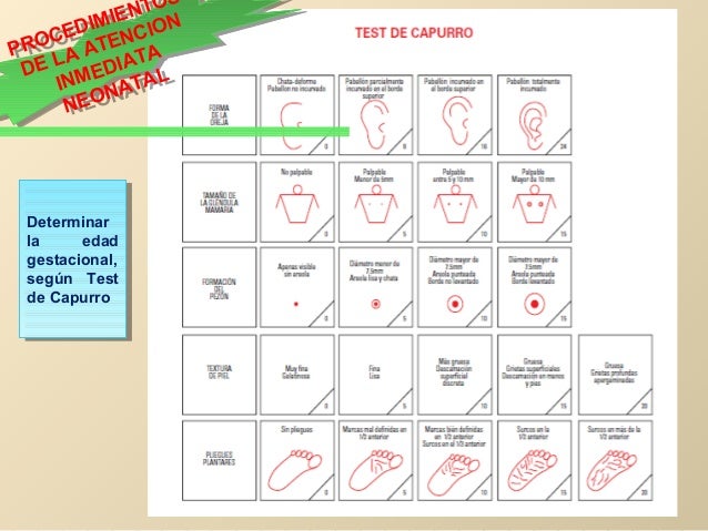 Test De Capurro En El Recien Nacido Pdf - corecompu