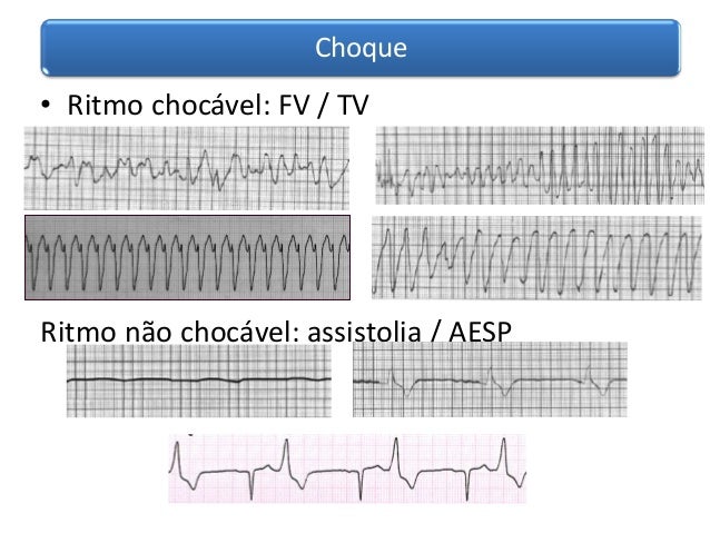 Atendimento na parada cardiorrespiratória em adultos pela equipe mult…