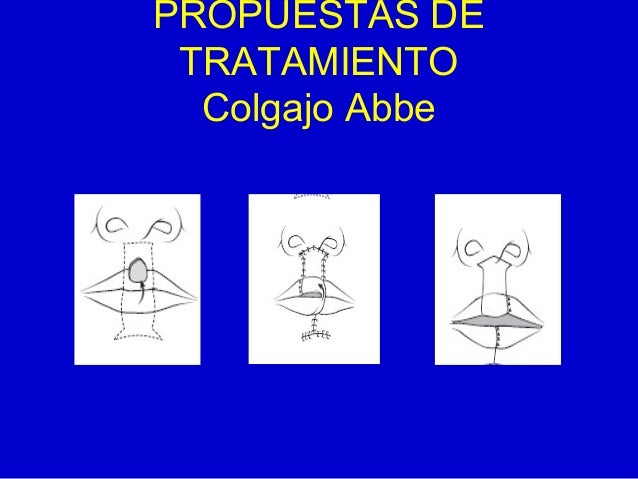 Ateneo trauma de labio superior