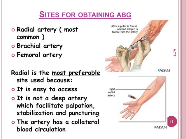 ATERIAL BLOOD GASES.ppt hoog hook goodnhn | PPT