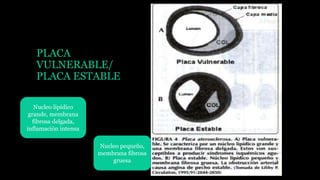 ATEROESCLEROSIS (1).pptx