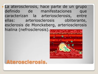 Aterosclerosis | PPTX