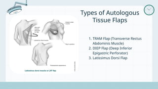 Breast Incision and Reconstruction .pptx